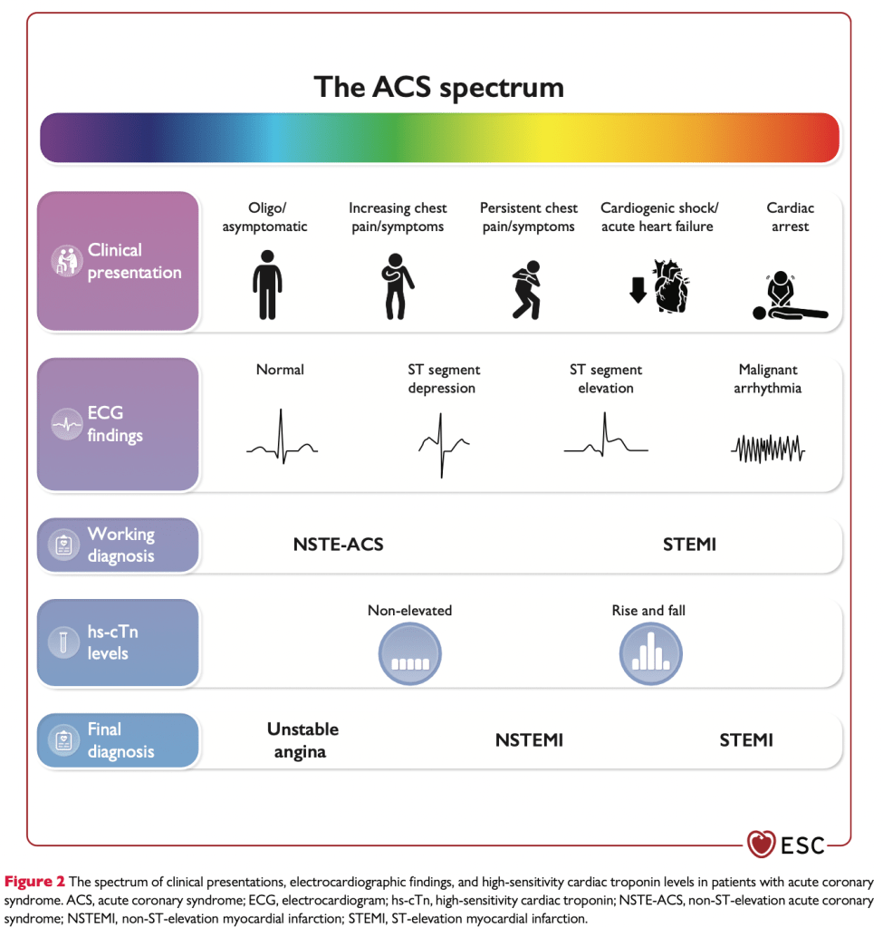 ESC Guidelines 2023 ACS: Fokus Präklinik | FOAMINA